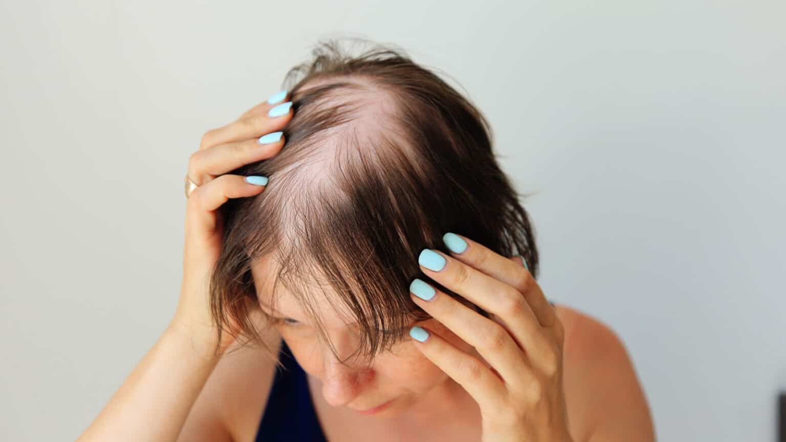 Understanding Thinning Hair in Women: Causes and Solutions - The Queen Zone