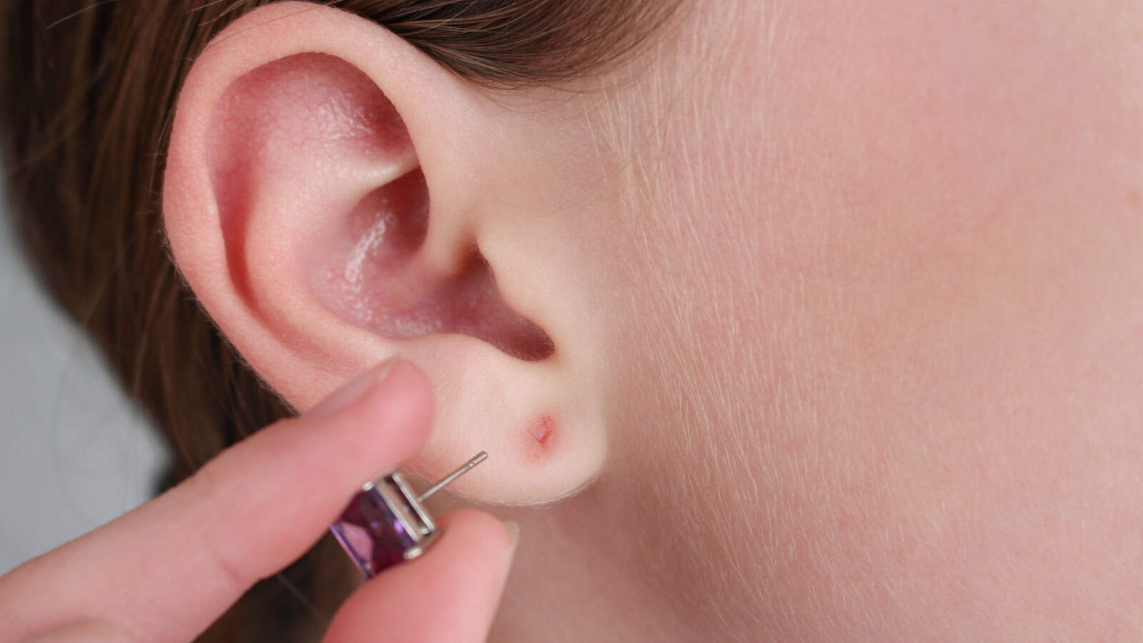 Earrings Hurting Your Ears? This Is Why & What You Can Do About It ...