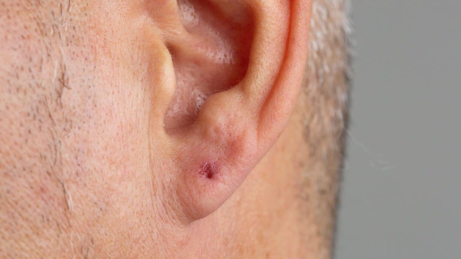 Earrings Hurting Your Ears? This Is Why & What You Can Do About It ...