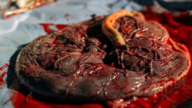 Placental Analysis: The Game-Changing Practice That Could Improve ...