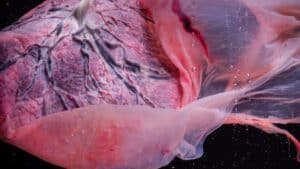 Placental Analysis: The Game-Changing Practice That Could Improve ...