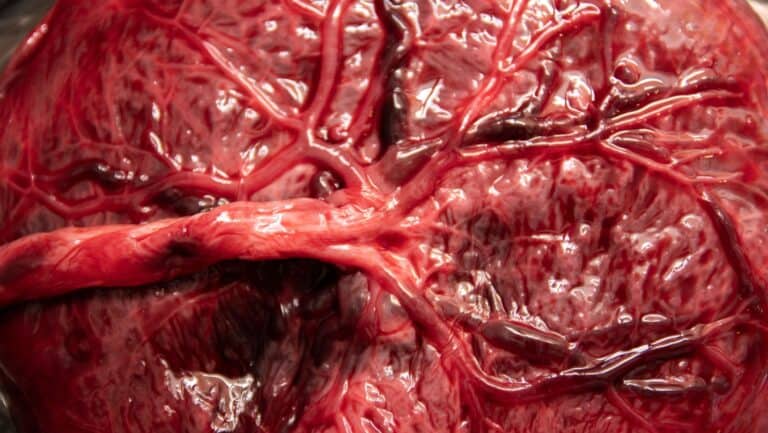 Placental Analysis: The Game-Changing Practice That Could Improve ...