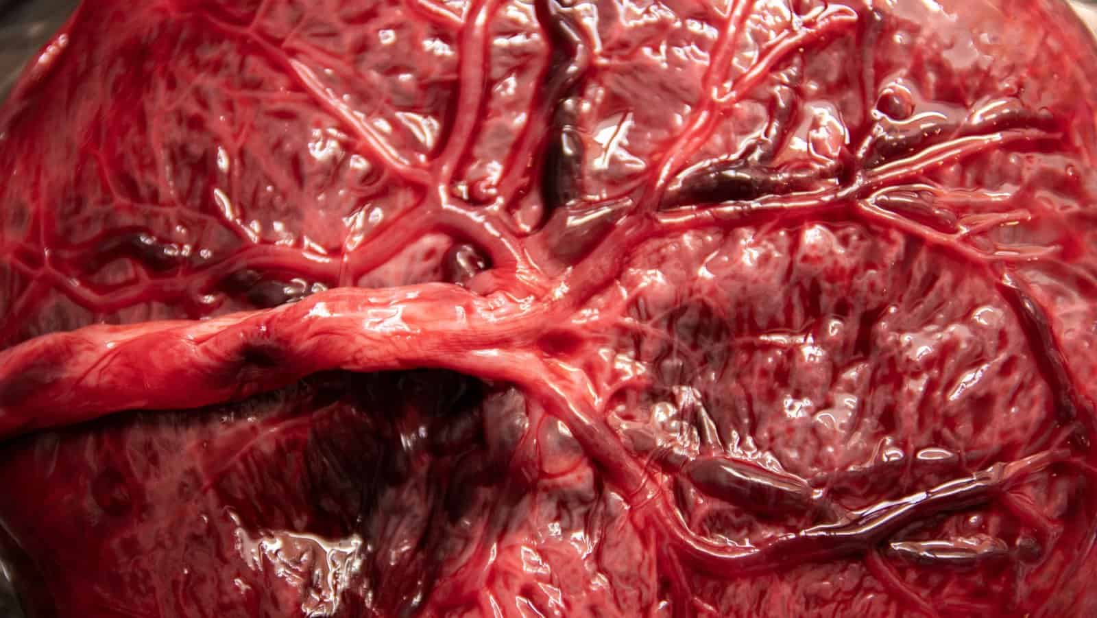 Placental Analysis: The Game-Changing Practice That Could Improve ...