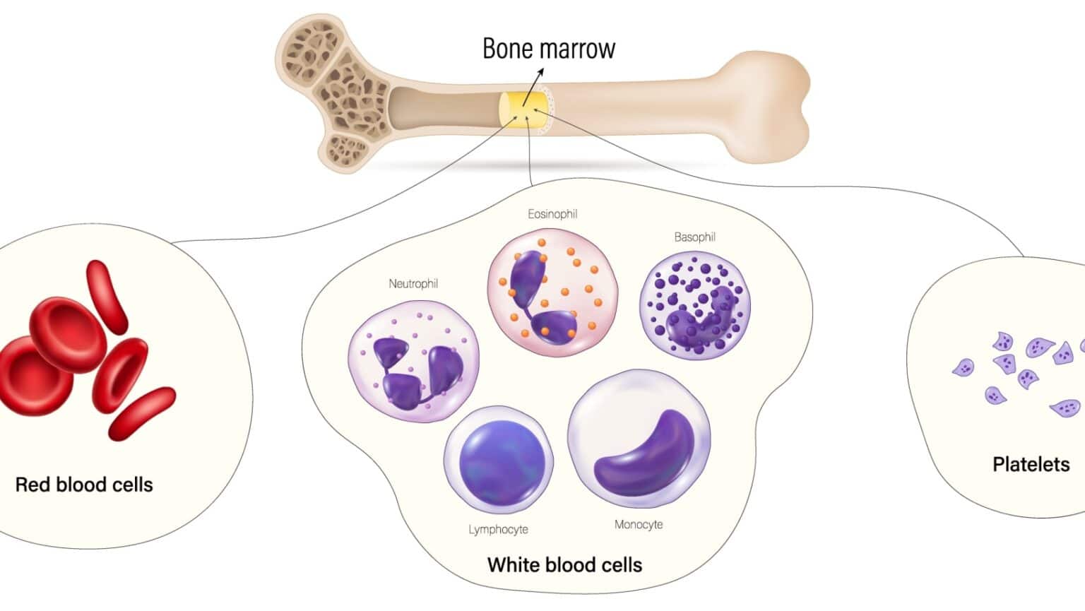 10 Subtle Signs of Multiple Myeloma You Shouldn't Ignore - The Queen Zone